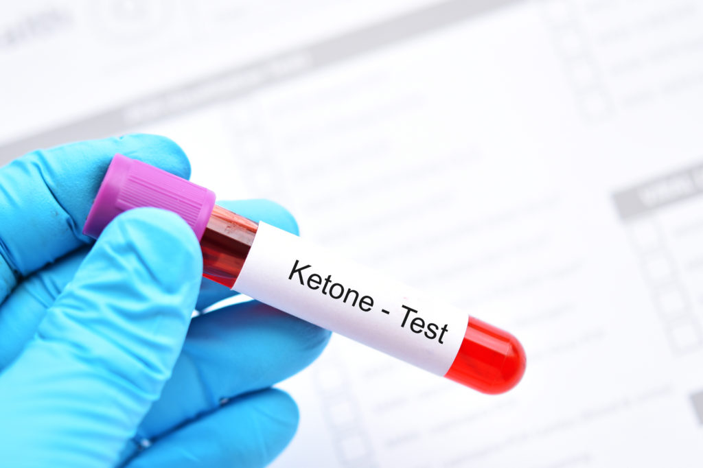 Worried About Ketones: 10 Signs You're in Ketosis | Keto-Vegan